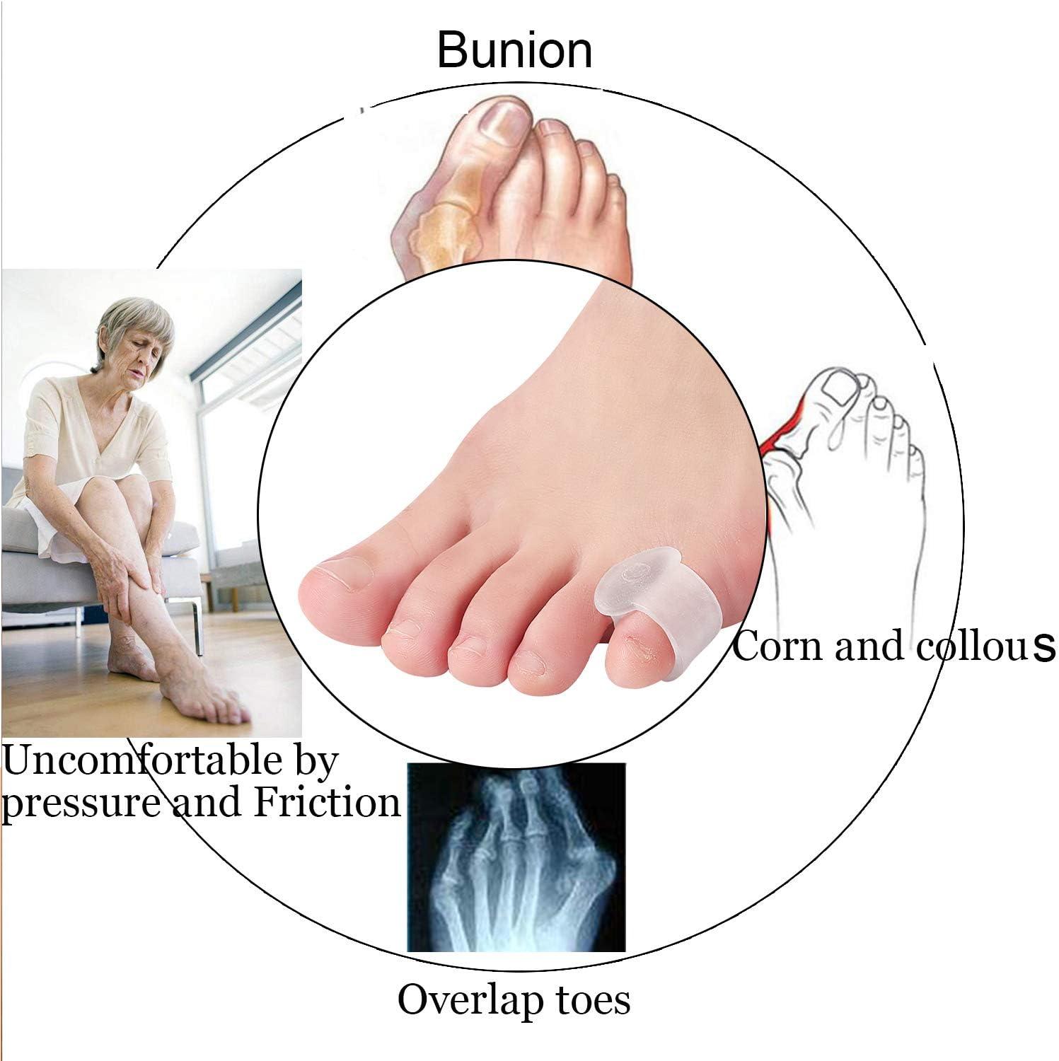 Pinky Toe Splint and Gel Separator Set| Bunion Corrector and Relief for ...
