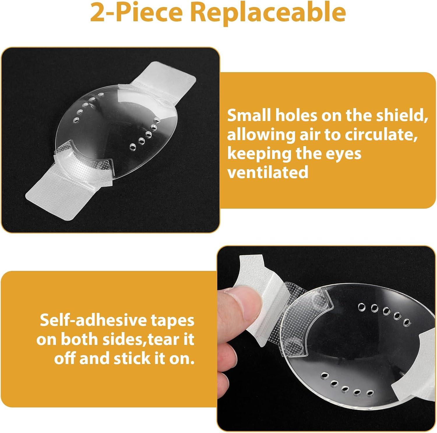 shield like cataract