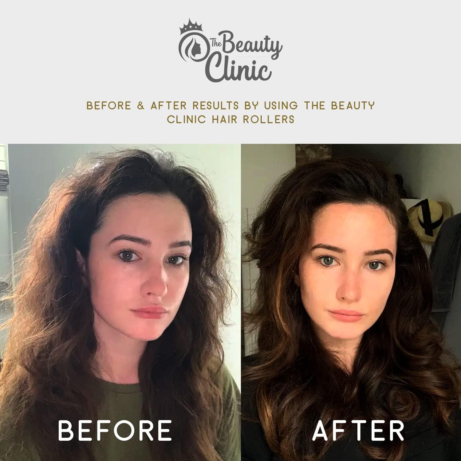 rollers before and after