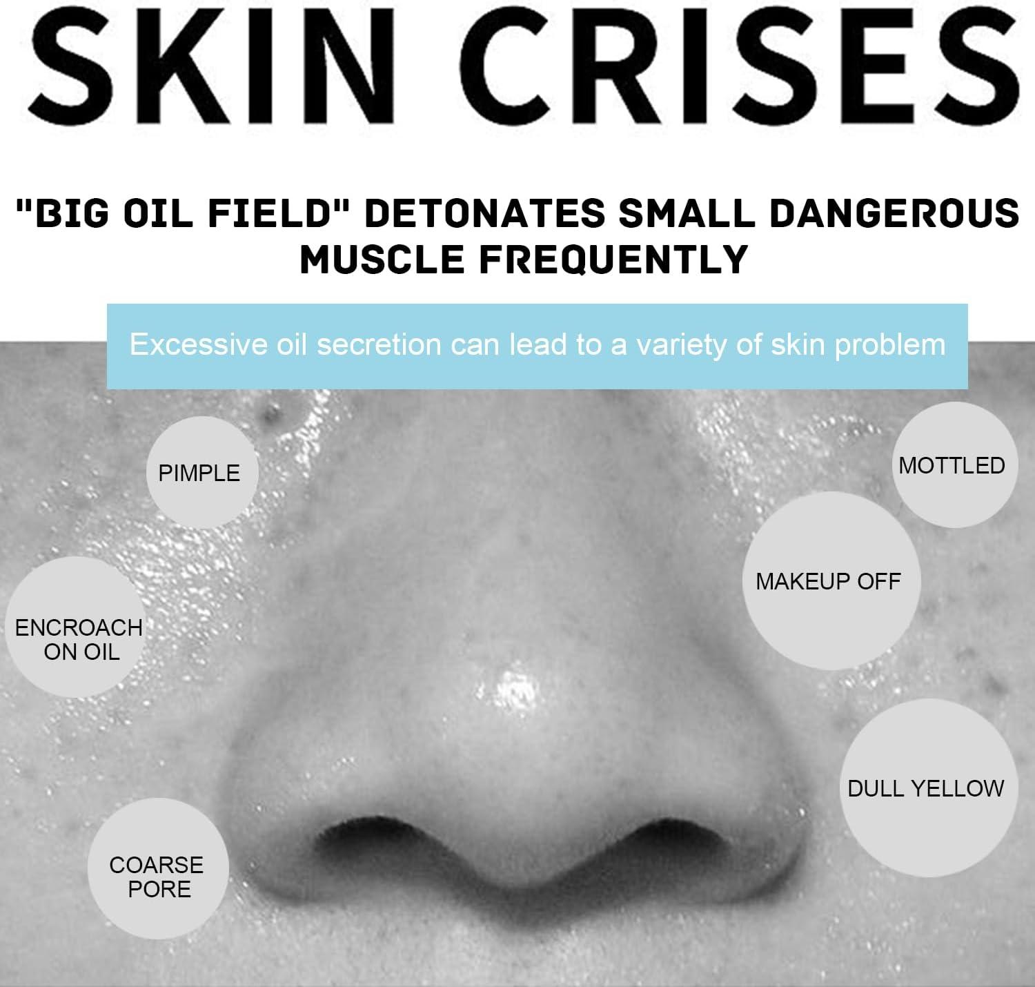 Acooruiteng Blotting Paper for Oily Skin 400 Count Oil Control Face ...