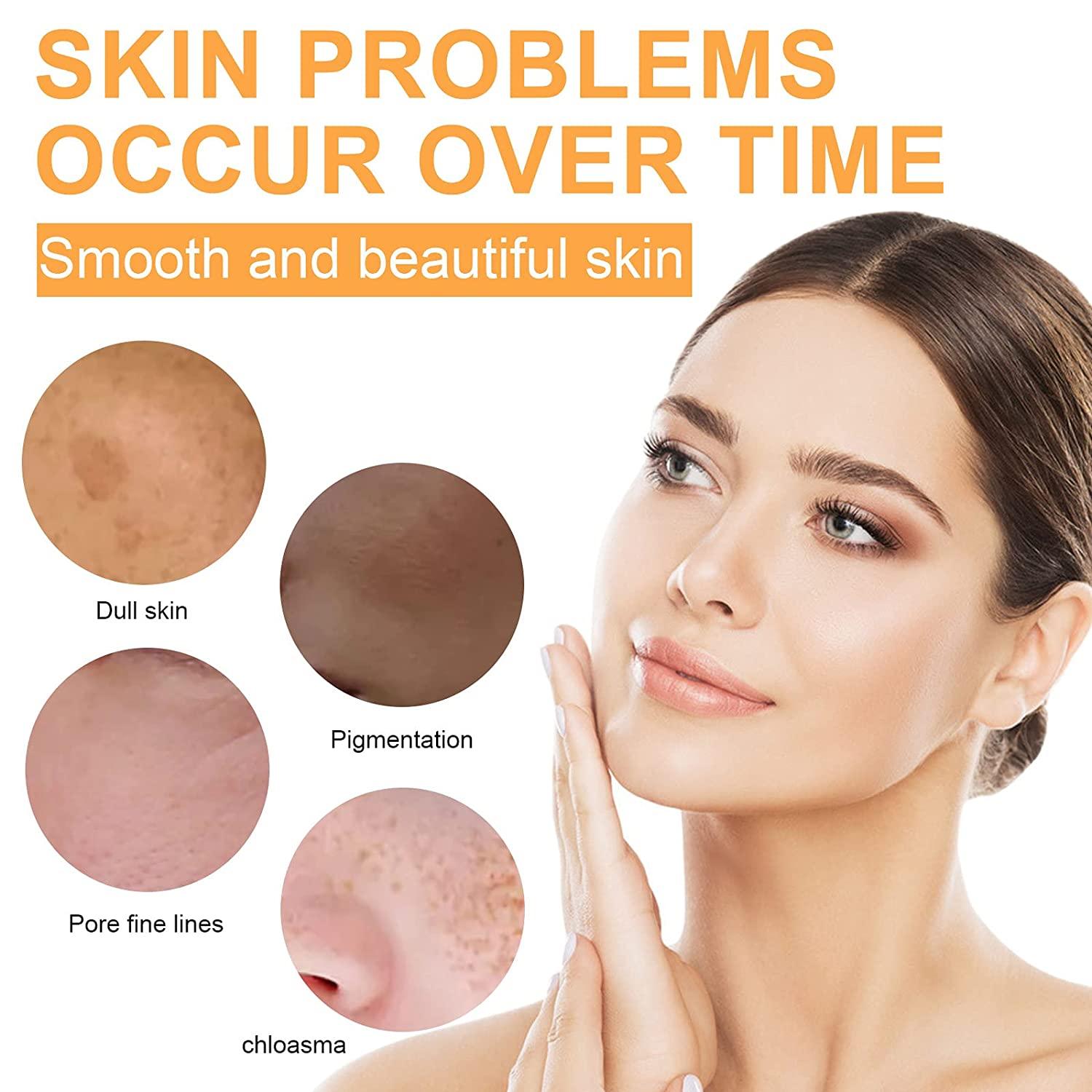 Dark Spot Corrector Cream for Face and Body | Niacinamide Age Spot ...