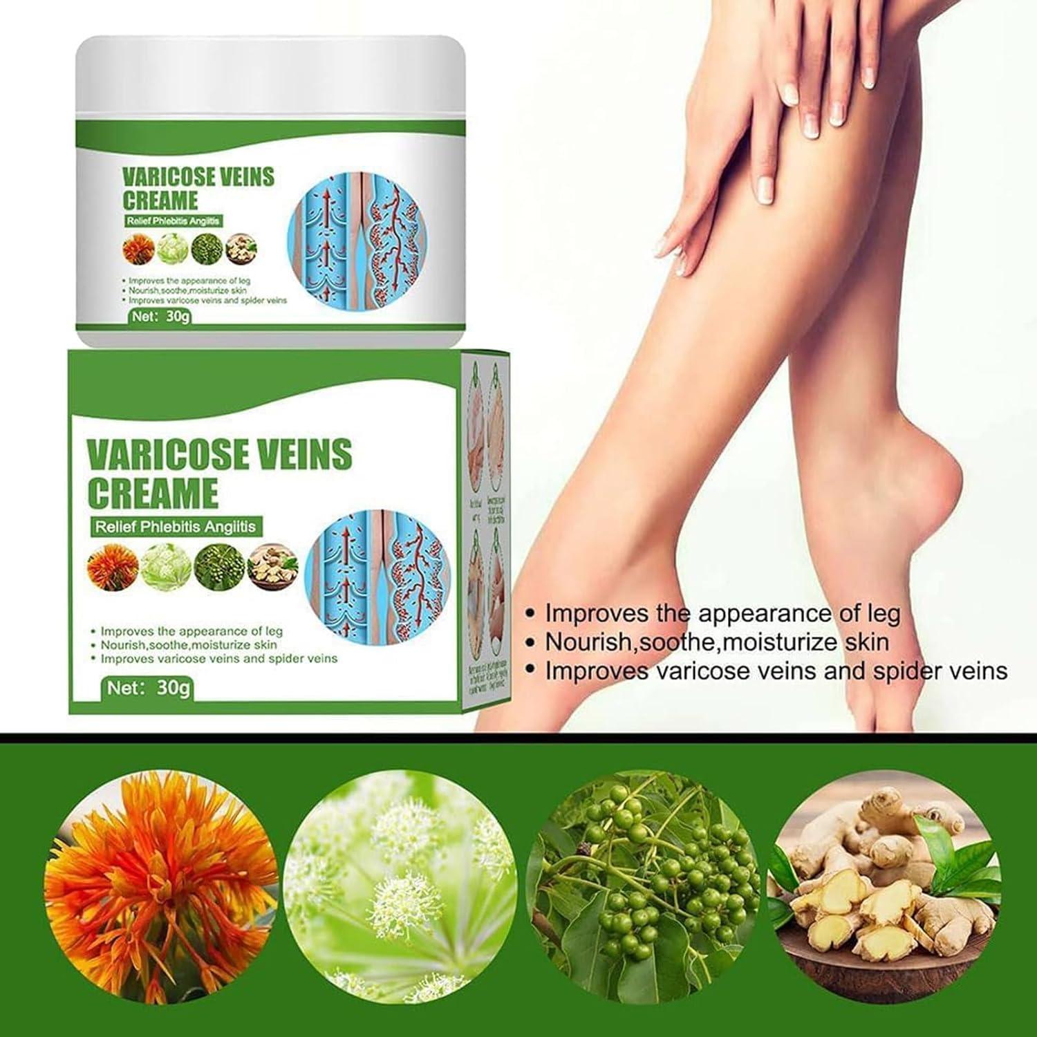 Varicose Veins Cream - 2pcs for Relief of Phlebitis, Angiitis ...