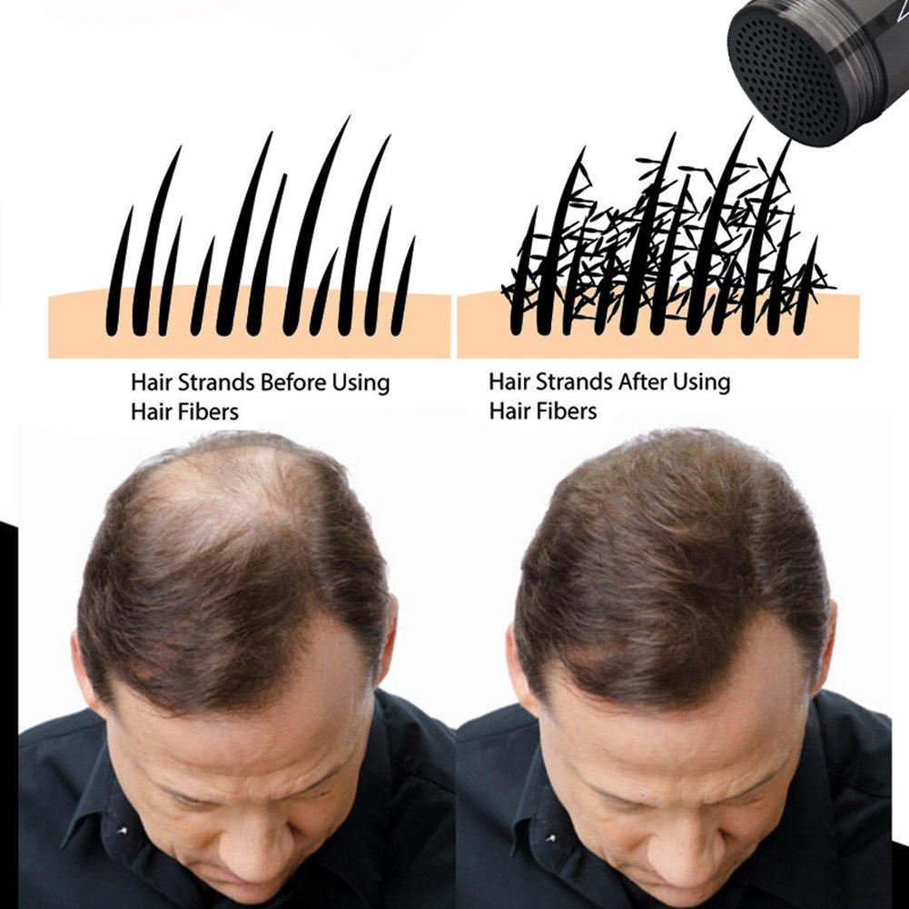 Natural Hair Loss Concealer - Hair Building Fibers for Men and Women 0 ...