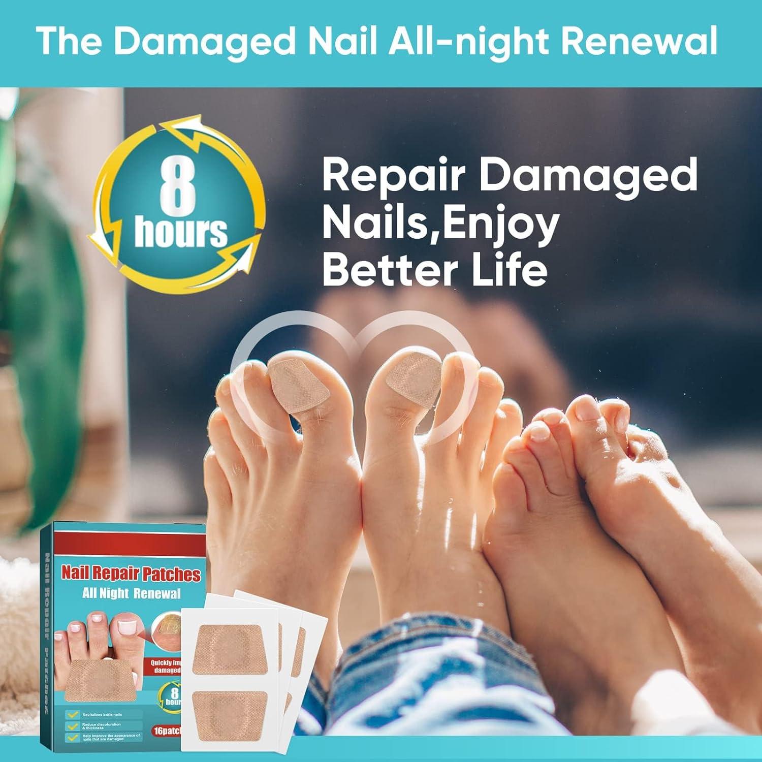 Nighttime Renewal Toe Nail Patches for Fungus - Fast & Effective Foot ...