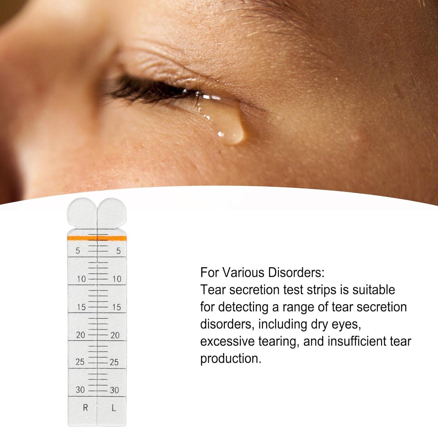 Ophthalmological Fluorescence Test Strips for Tear Secretion Disorders ...