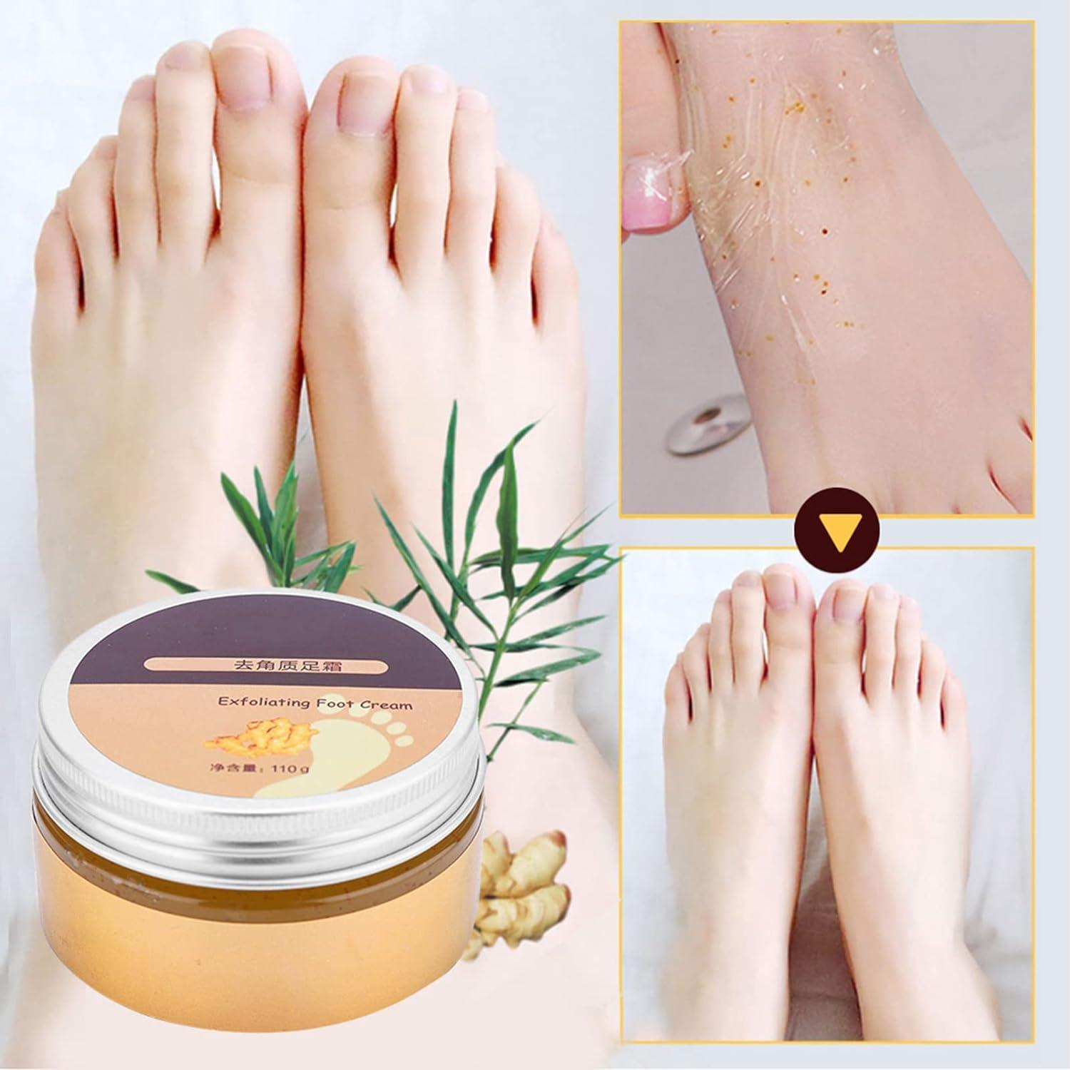 Foot Cream for Cracked Heels and Dry Skin Ginger Foot Exfoliating Cream ...