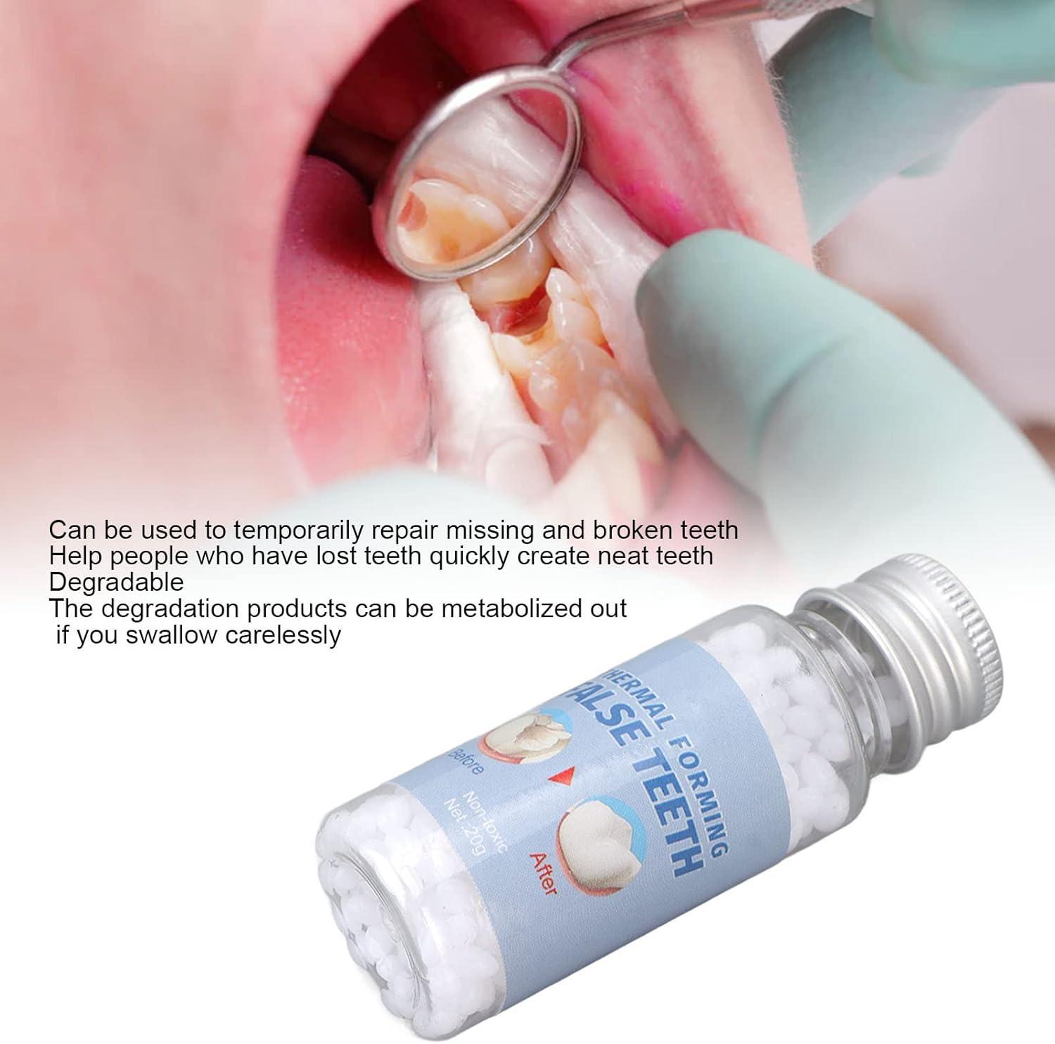 Tooth Repair Beads - 0.7oz White Resin for Temporary Tooth Filling ...