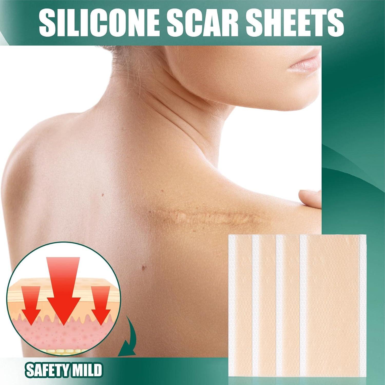 Milageto Plaster for Skin Scars - Reusable & Effective Treatment 15x4cm ...