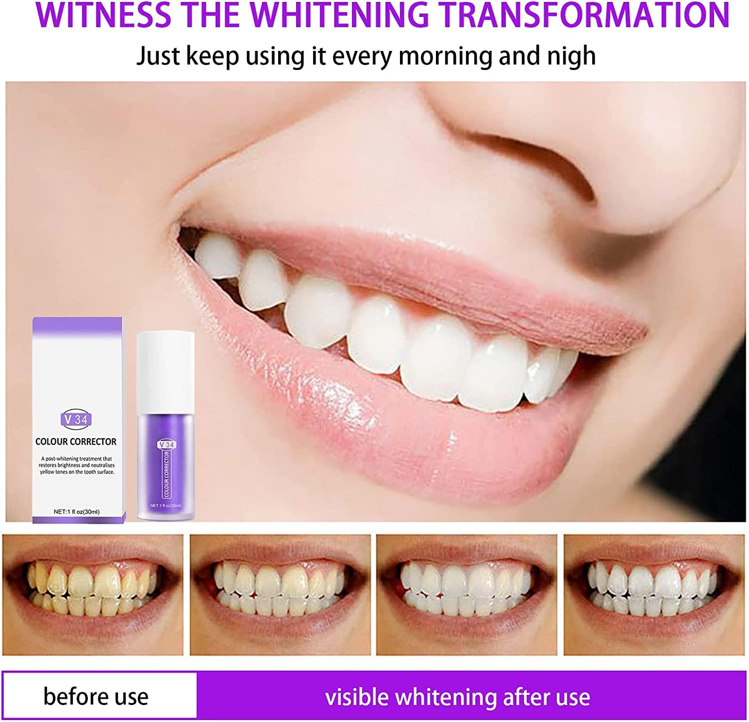 Teeth Whitening V34 Colour Corrector Toothpaste for Sensitive Teeth ...