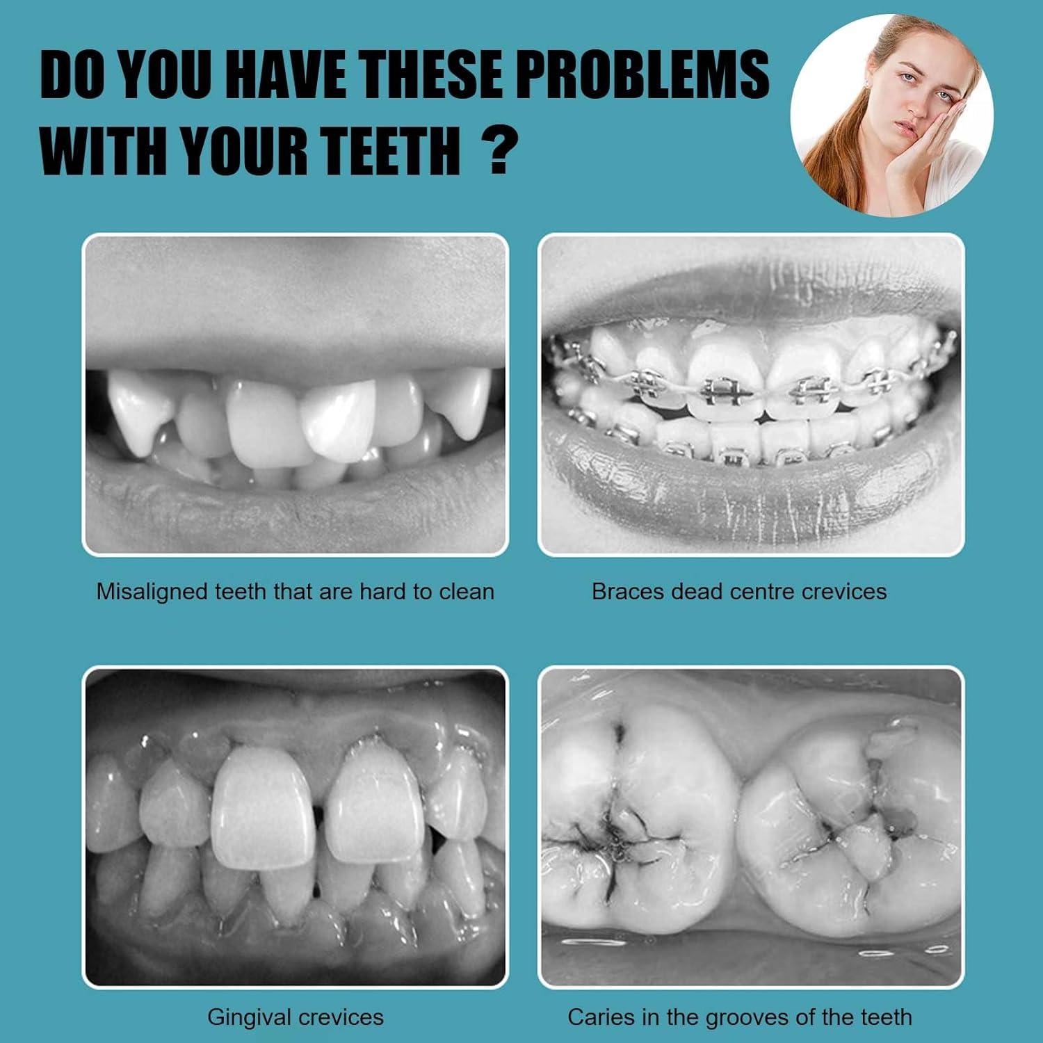 Interspace Toothbrush Set - 12 Soft Narrow Interdental Brushes for ...