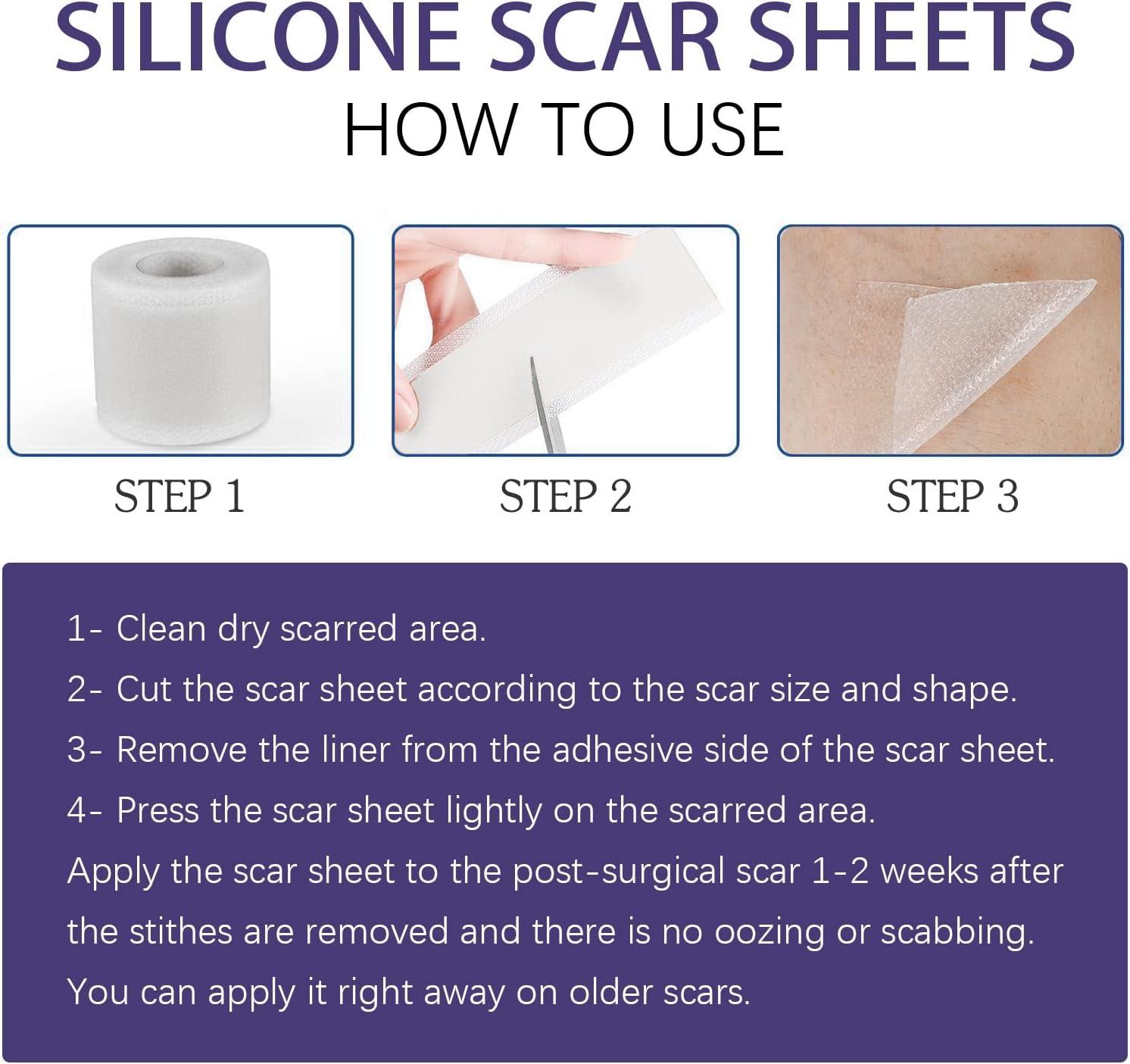 Silicone Scar Sheets - Surgical and Caesarean Scar Removal Tape for Men ...