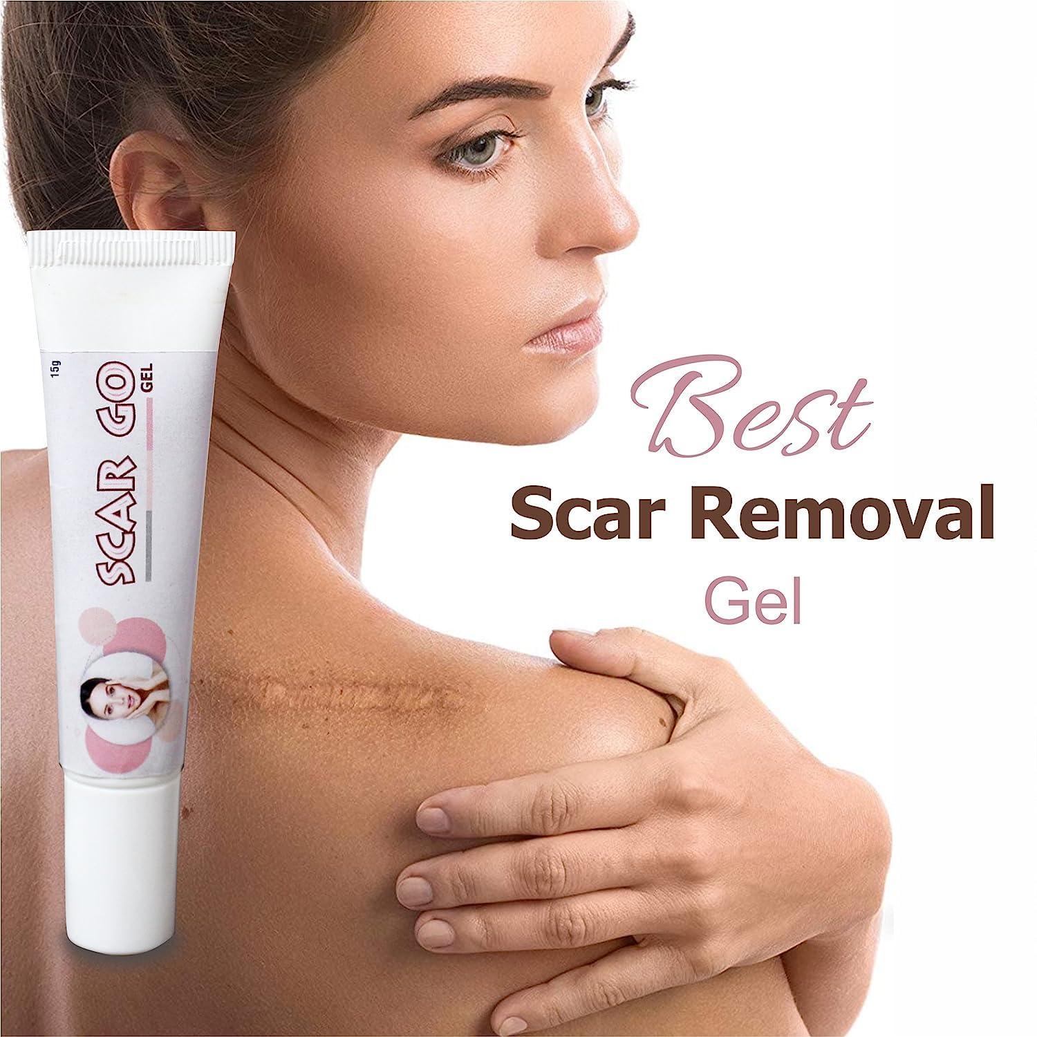 SS Anti-Scar Gel for Skin Lightening - 15 GM | For Old & New Scars ...