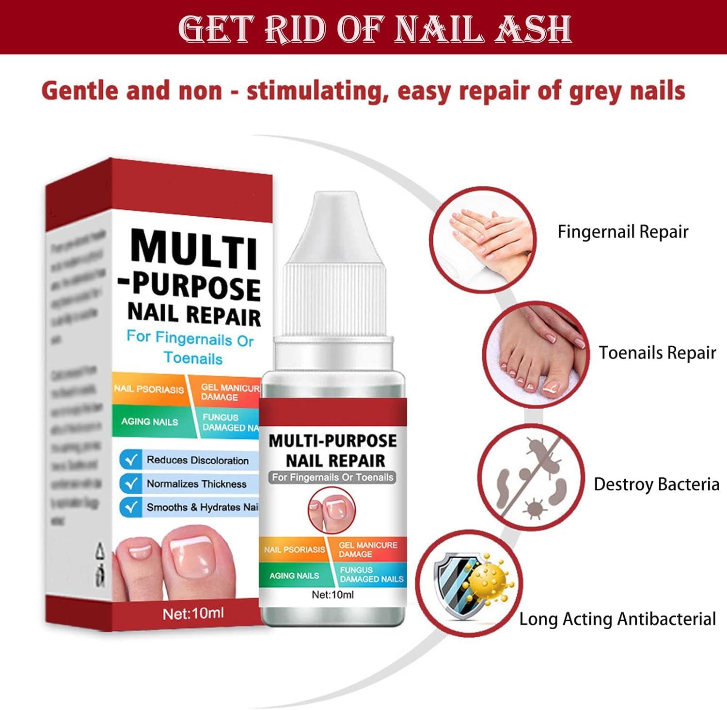 Fungal Nail Treatment for Toenail - Extra Strong Nail Repair Solution ...