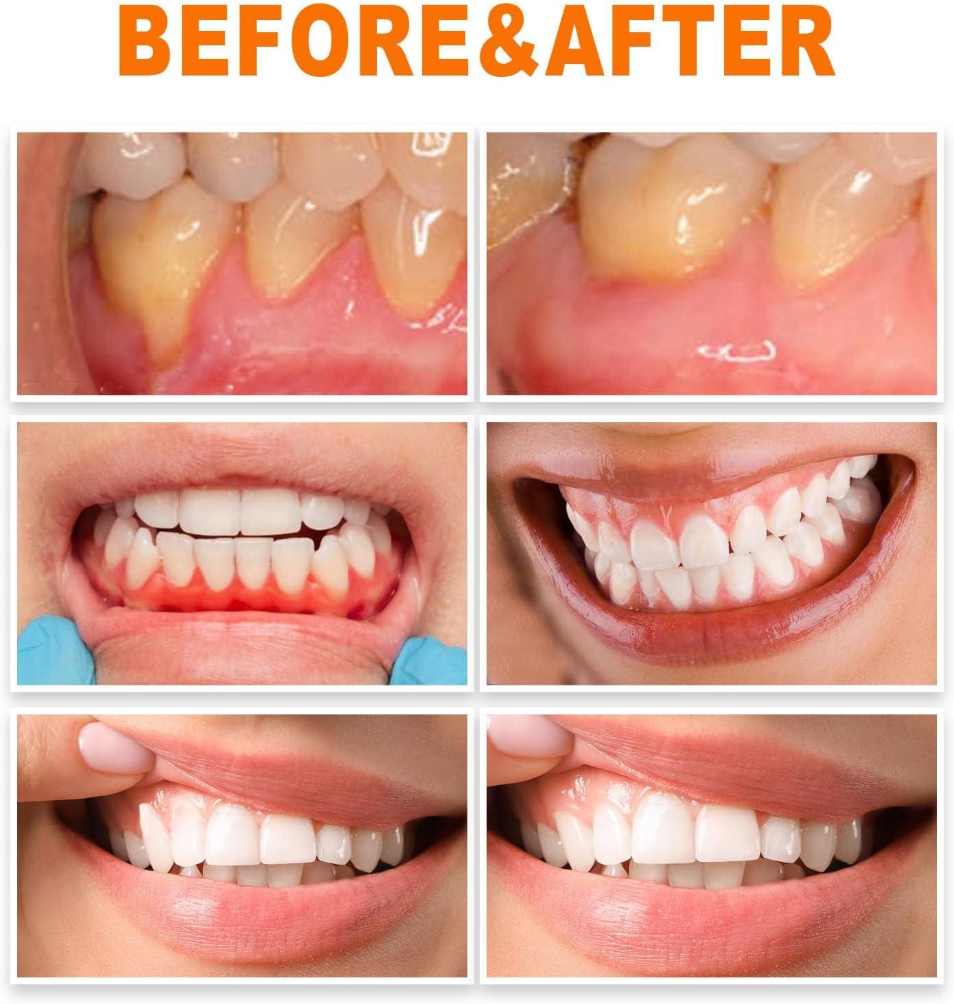 Toothpaste Toothing Meat Repair Essence Ampoules - Advanced Gum Care ...