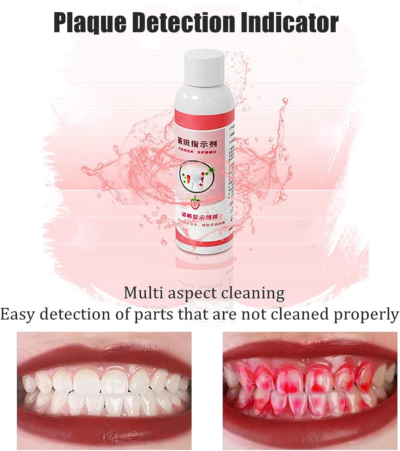 Plaque Disclosing Agent 60ml - Oral Tartar Test for Kids & Adults ...