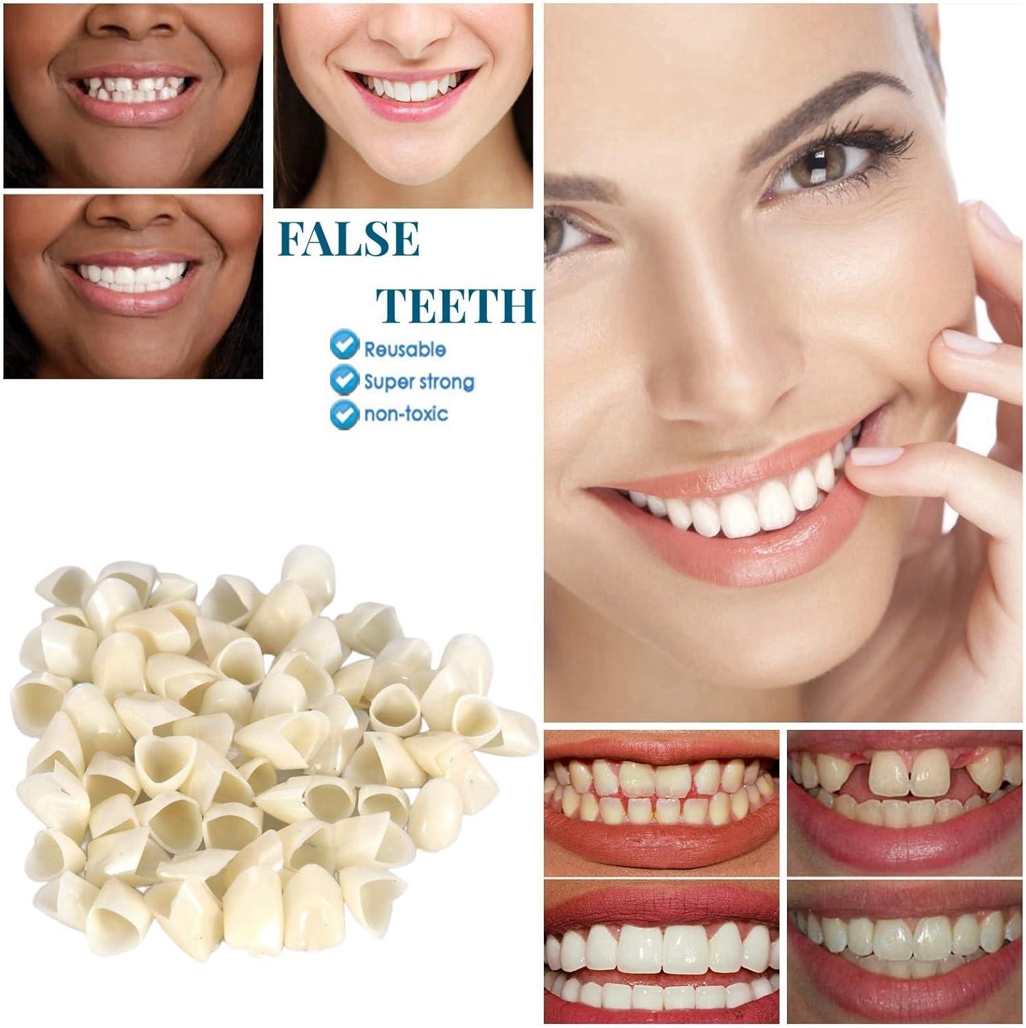 70PCS Temporary Tooth Crown Repair Kit - Fake Front Tooth Replacement ...