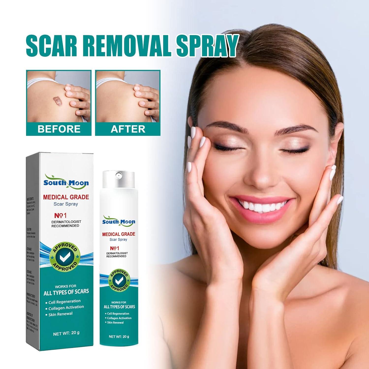 Scar Remove Advanced Spray - Eliminate Old, Pimple, and Stretchmark ...