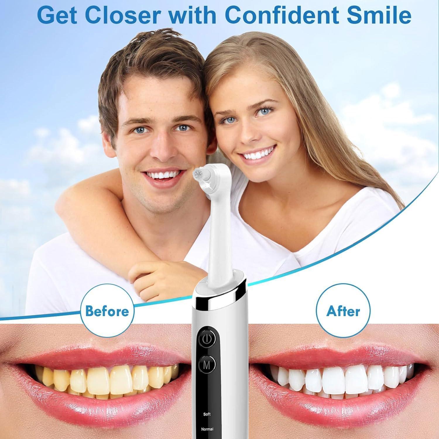 Electric Tooth Polisher Kit for Teeth Whitening & Stain Removal ...