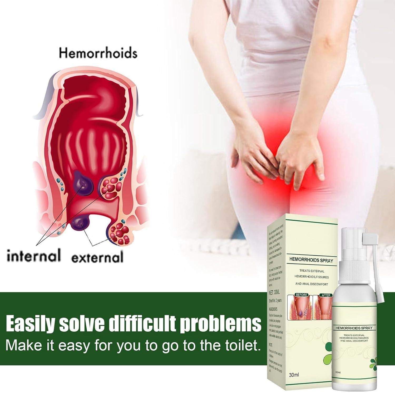 Hemorrhoids Treatment Spray for Fast Relief - 30ml | Natural Hemorrhoid Relief for Anal Itching ...