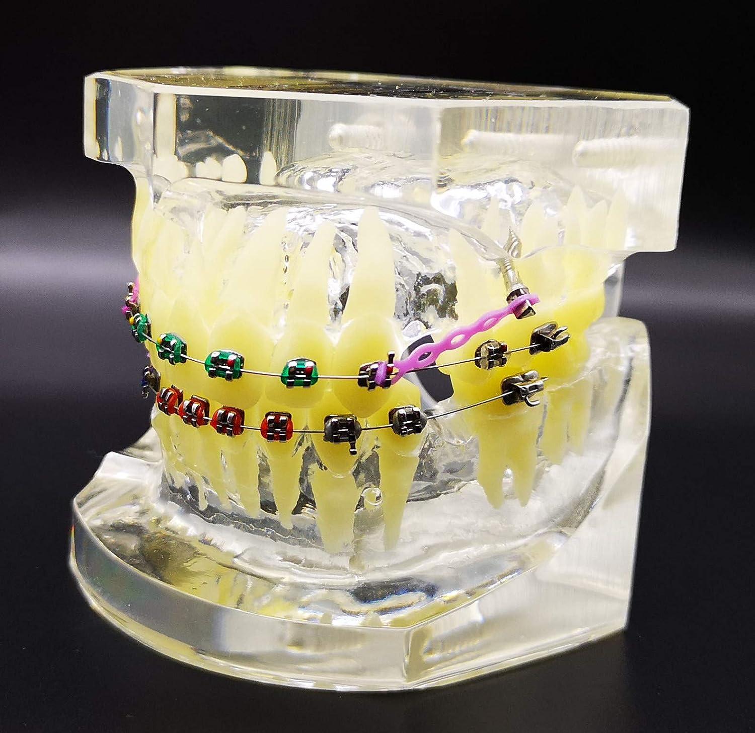Dental Typodont Orthodontic Teeth Model with Metal Braces & Ligature ...
