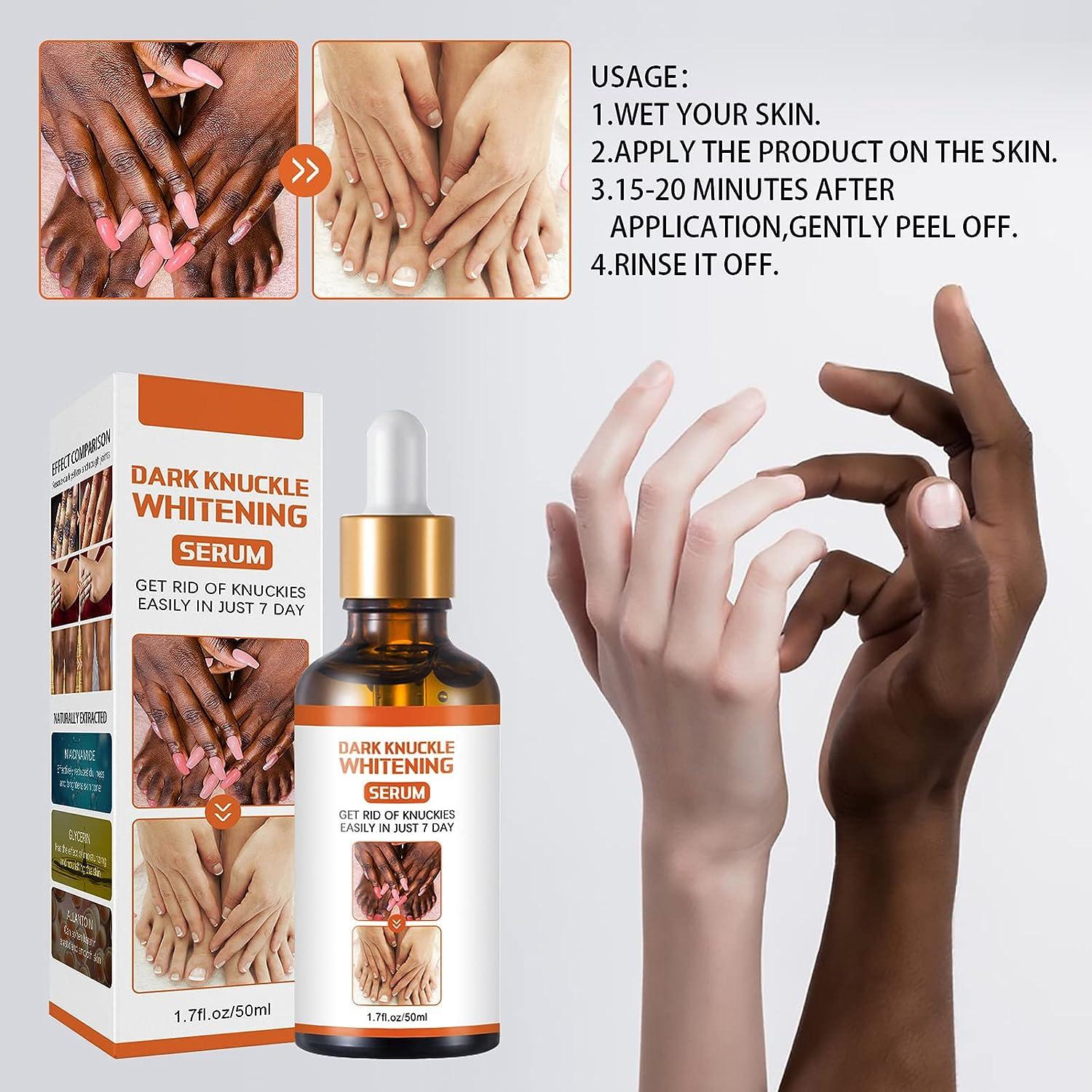 Dark Knuckle Whitening Serum 1.7 Fl Oz - Repair Melanin, Lighten Skin ...
