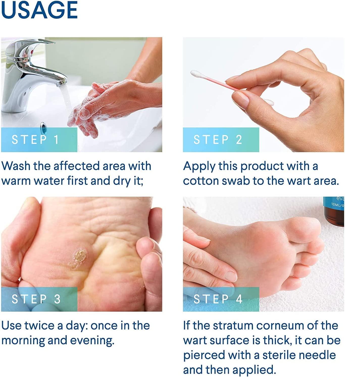 Evagloss Natural Wart Remover - Maximum Strength Liquid Gel for Plantar ...