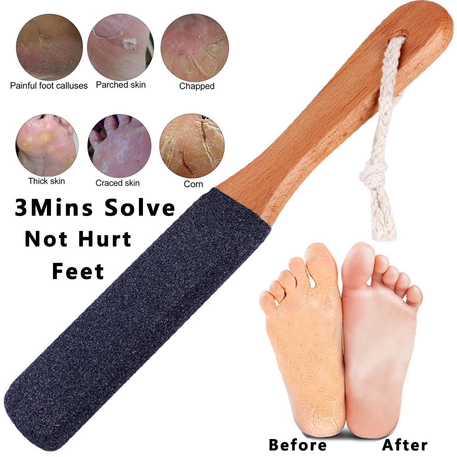 Kinepi Professional Foot File Callus Remover & Scrubber for Cracked ...