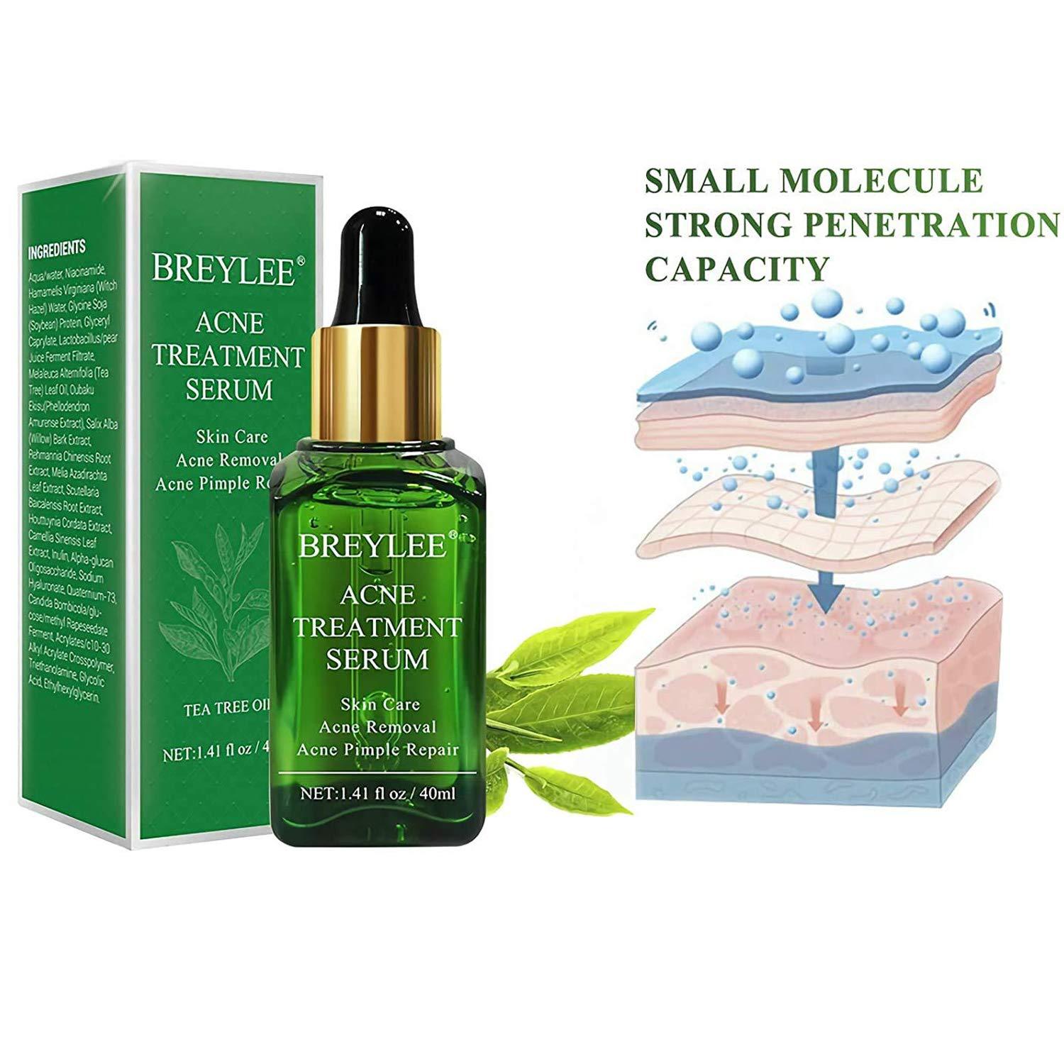 Tea Tree Acne Treatment Serum - Clear Severe Acne Breakouts & Repair ...