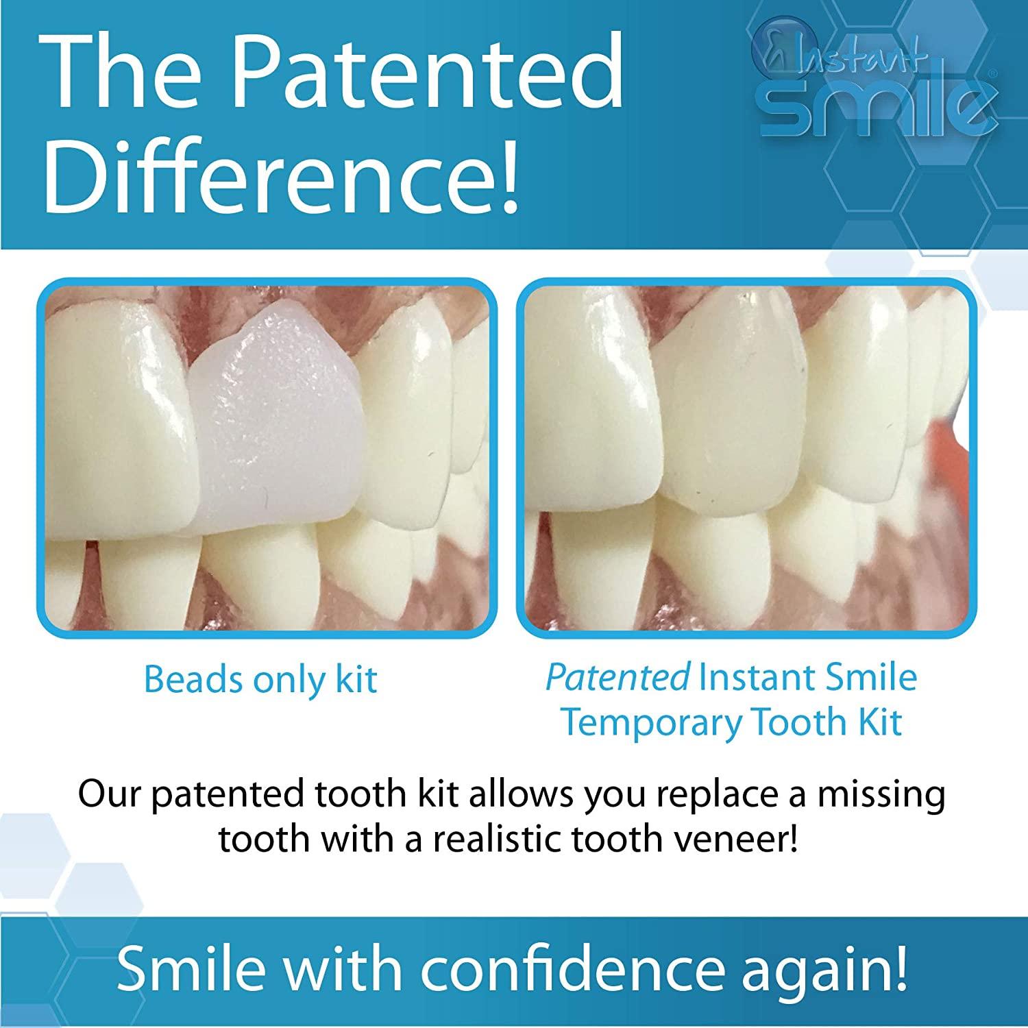 Instant Smile Tooth Replacement Kit - Complete Your Smile in Minutes ...