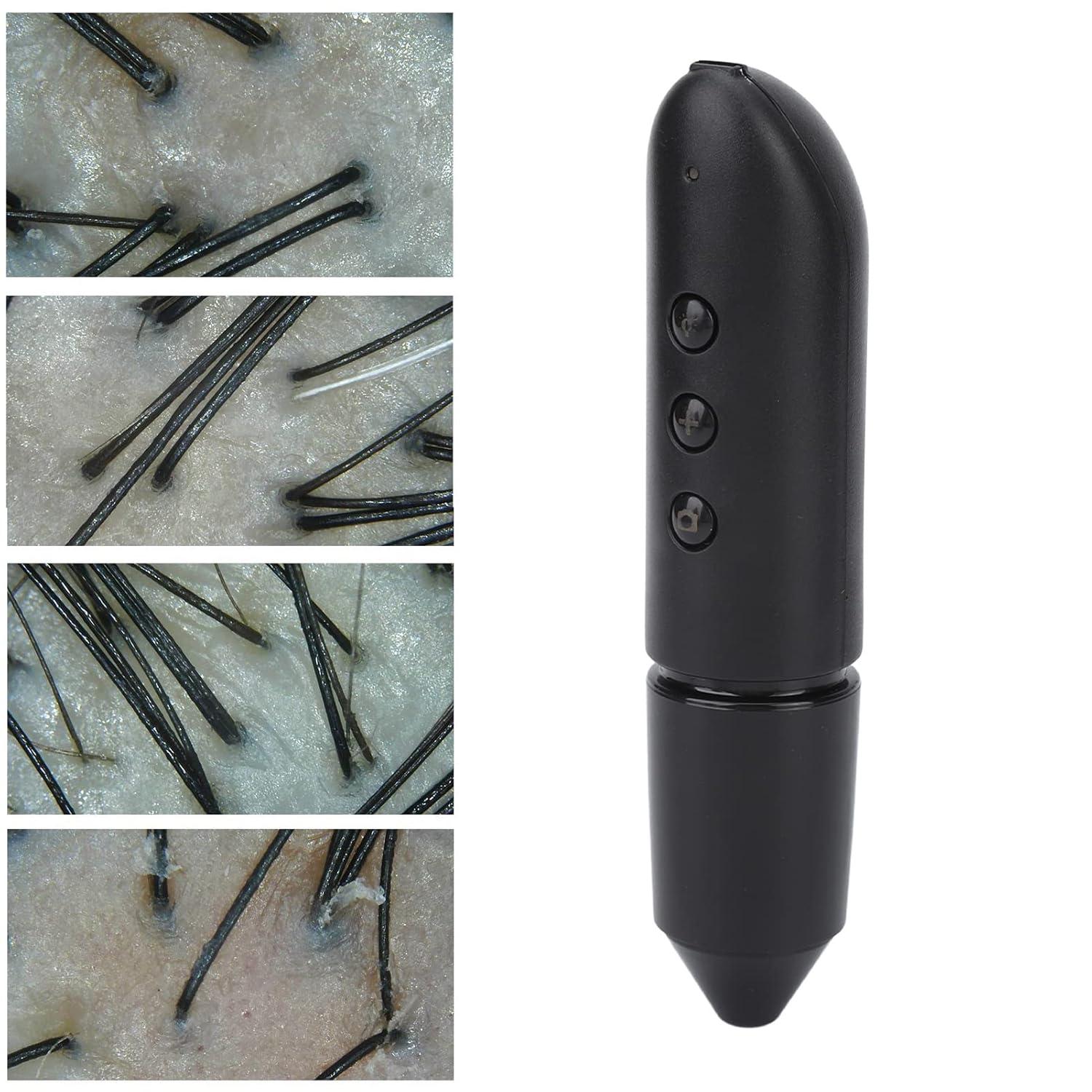 Skin Hair Detector 0.3MP Camera - 100x Magnification Follicle Scalp ...