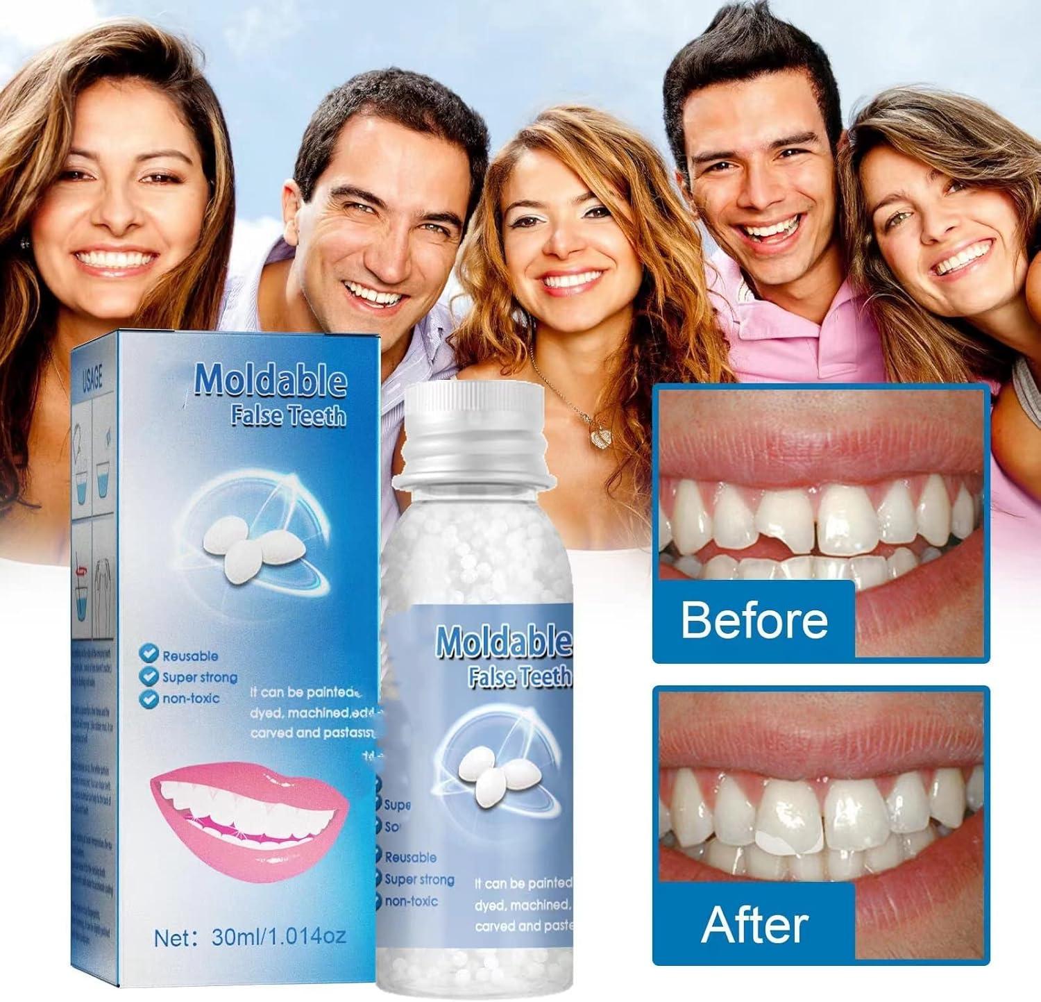 Tooth Repair Granulate - Temporary Tooth Repair Set for Broken Teeth ...