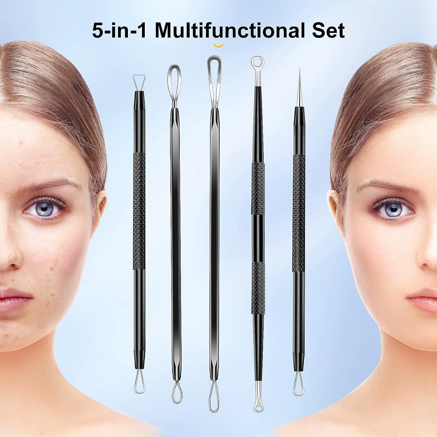Blackhead & Pimple Extractor Tool Kit for Face - Blemish & Whitehead ...