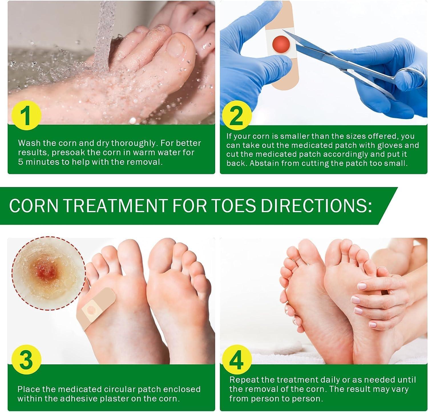 corn on pinky toe inside