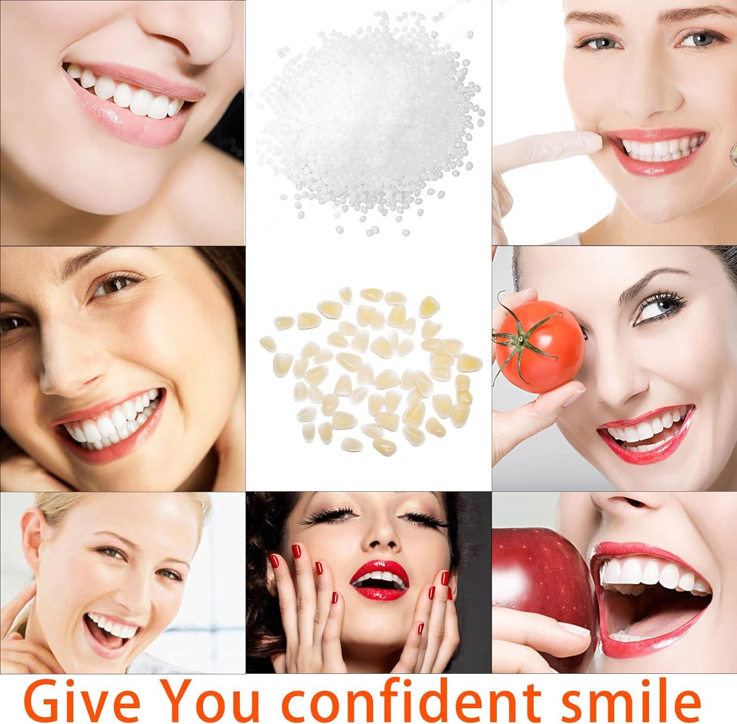 Dental Repair Kit for Temporary Tooth Fix | Tooth Filling Replacement ...