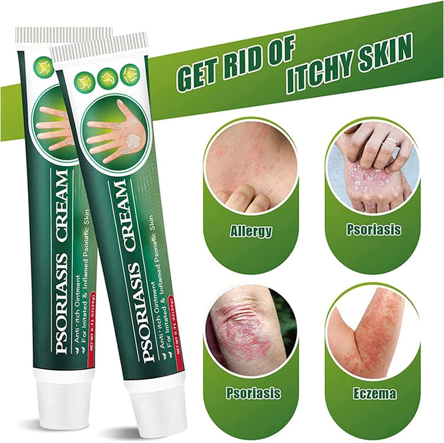 JOOTOO Psoriasis Cream Natural Chinese Herbal Cream Eczema Dermatitis ...