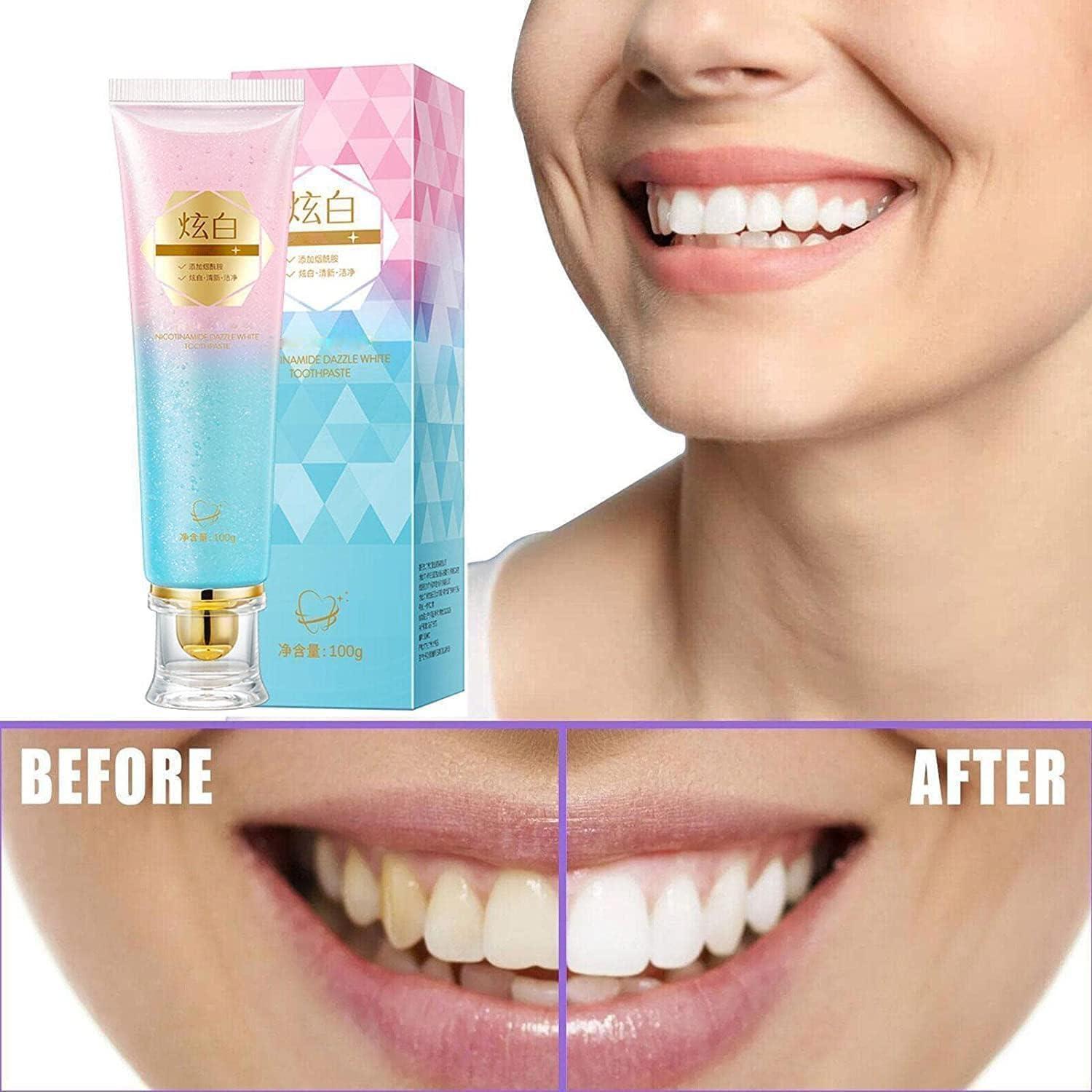 Niacinamide Toothpaste for Brightening & Stain Removal | Fresh Breath ...