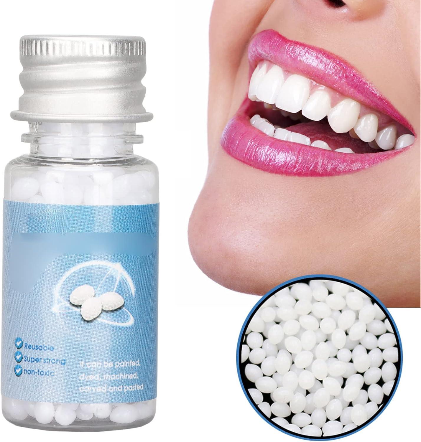 Tooth Repair Set - Temporary Dental Filling Beads for Quick Repairs of ...