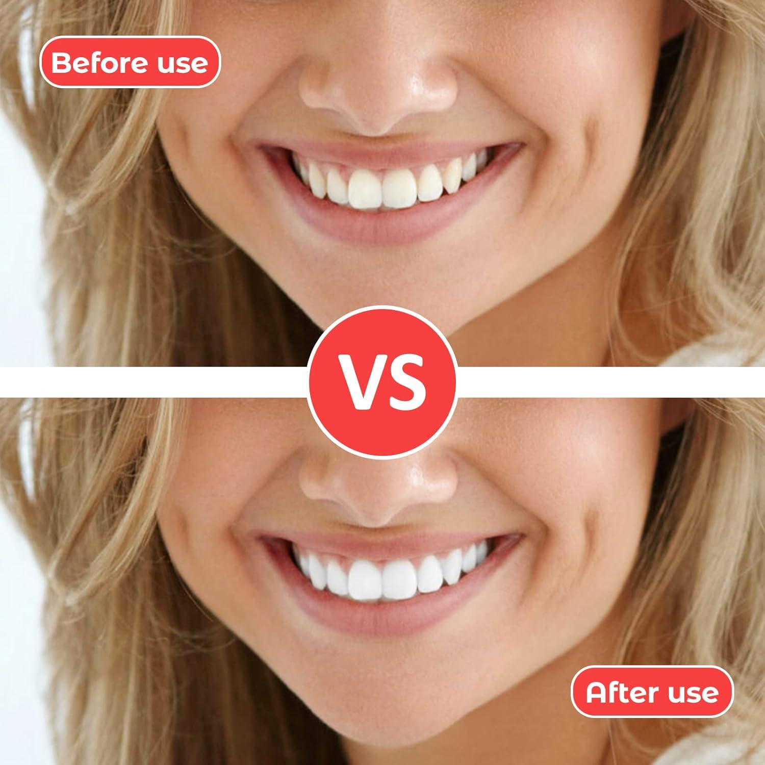 100 Interdental Brushes for Effective Oral Hygiene | Dental Care Tooth ...