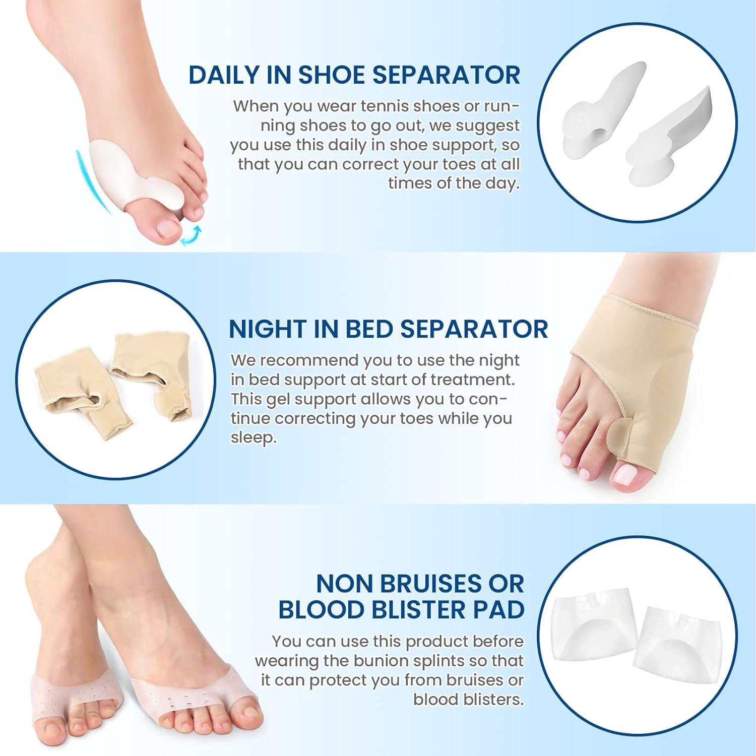 pinky toe bunion splint