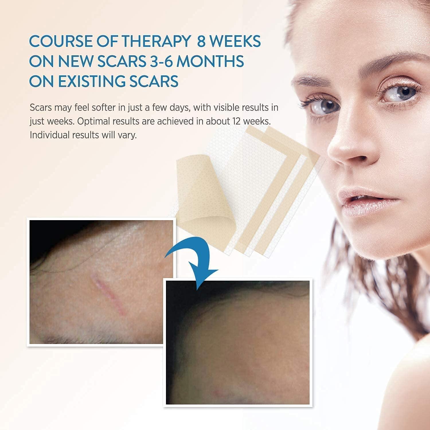 KAIJIELY Silicone Scar Sheets 6 Strips for Surgical Scars | C-Section ...