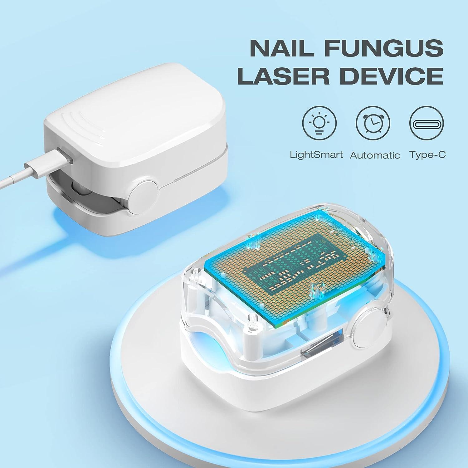 Home-Use Nail Fungus Cleaning Laser Device for Toenail & Fingernails ...