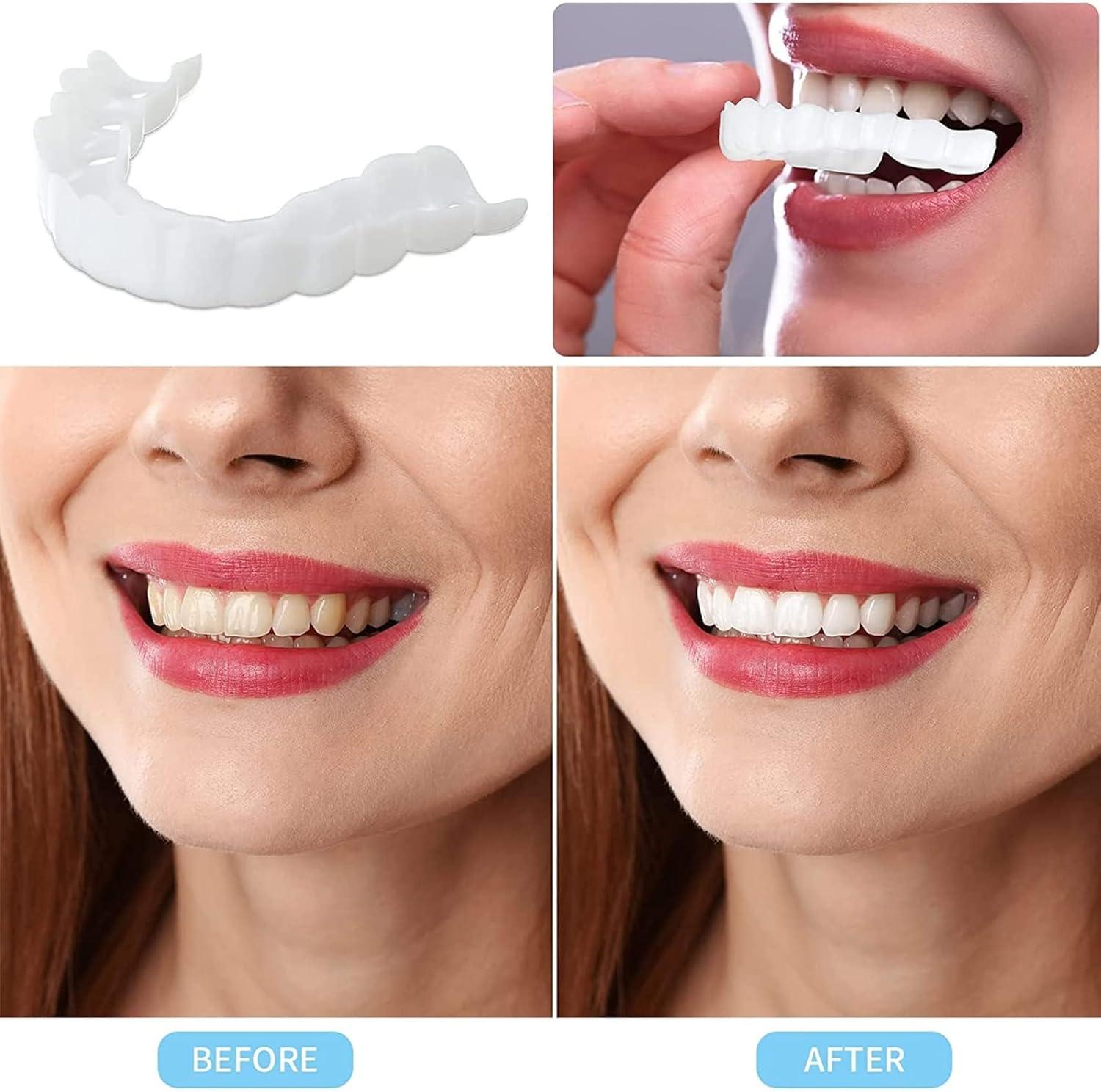 Flipped Warm 2 Pair Veneers Teeth - Plug-In Artificial Teeth Lightening ...