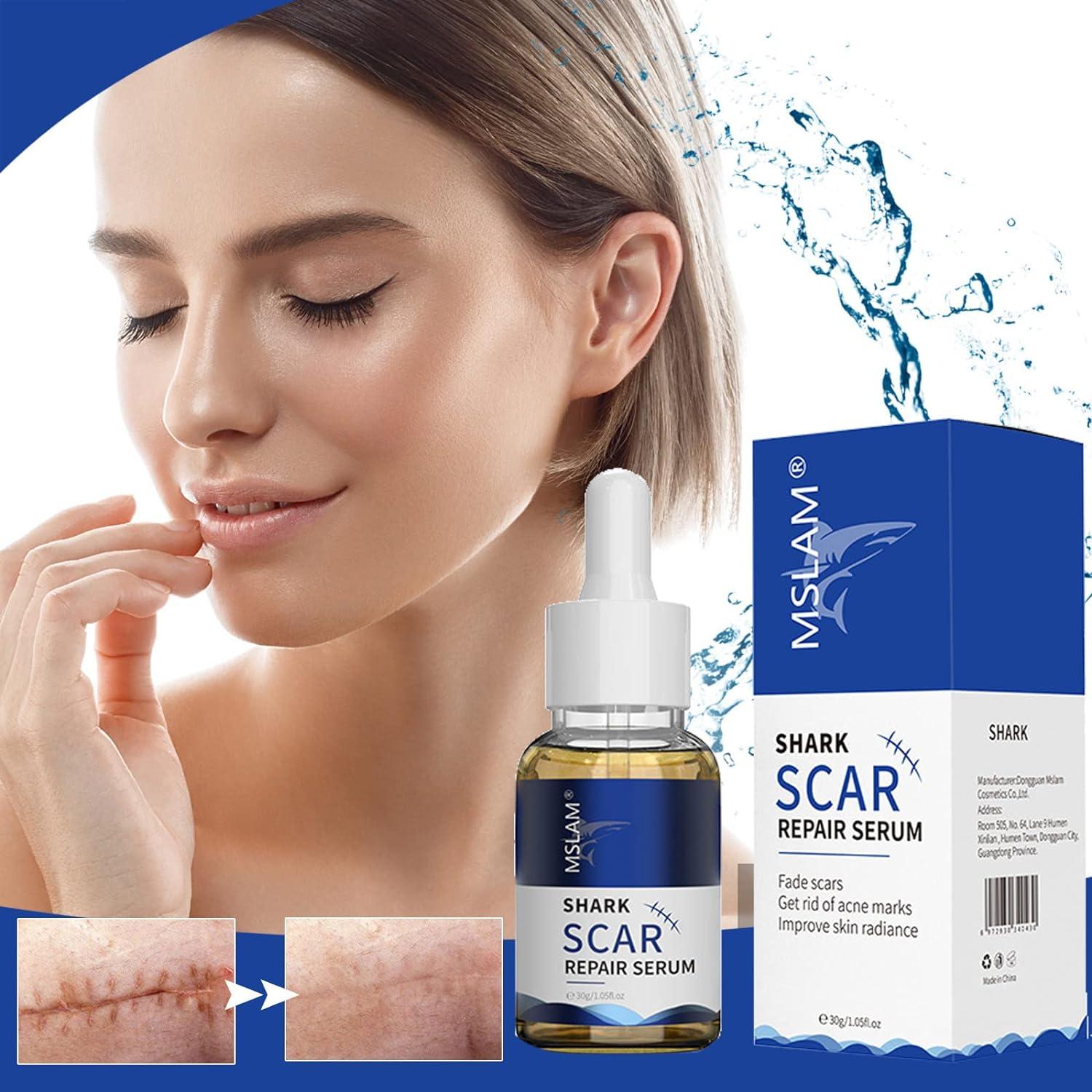 Scar Water Scar Liquid 30ml Scar Moisturizing Oil with Selfie Lip ...