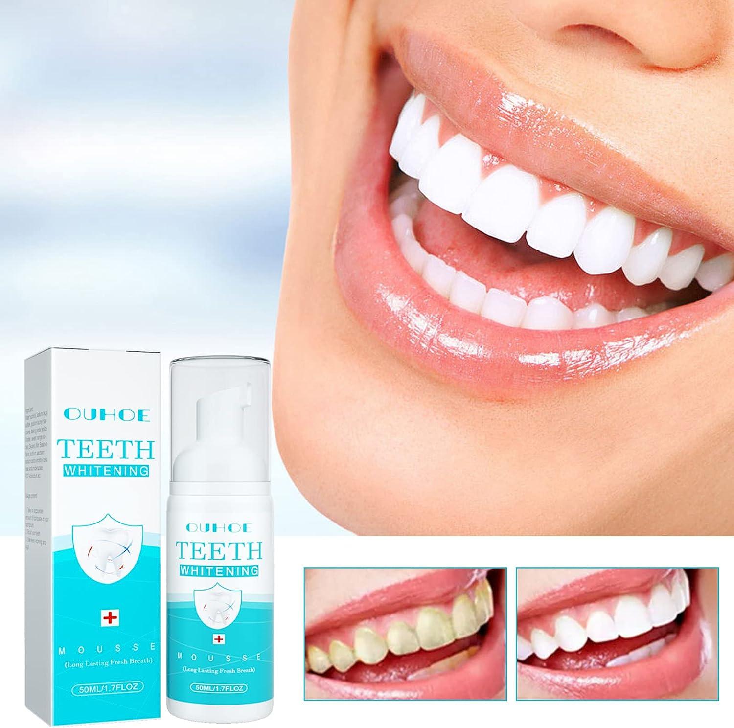 2Pcs Teeth Whitening Mousse Mouthwash - Stain Removal & Brightening