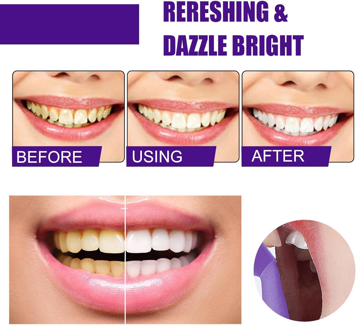 3-Part Whitening Toothpaste Set - Daily Cleaning Spot Removal Fresh ...