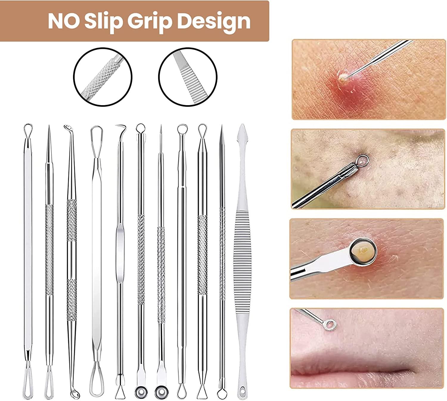 Dermated 16 PCS Blackhead Remover Pimple Popper Tool Kit | Stainless ...