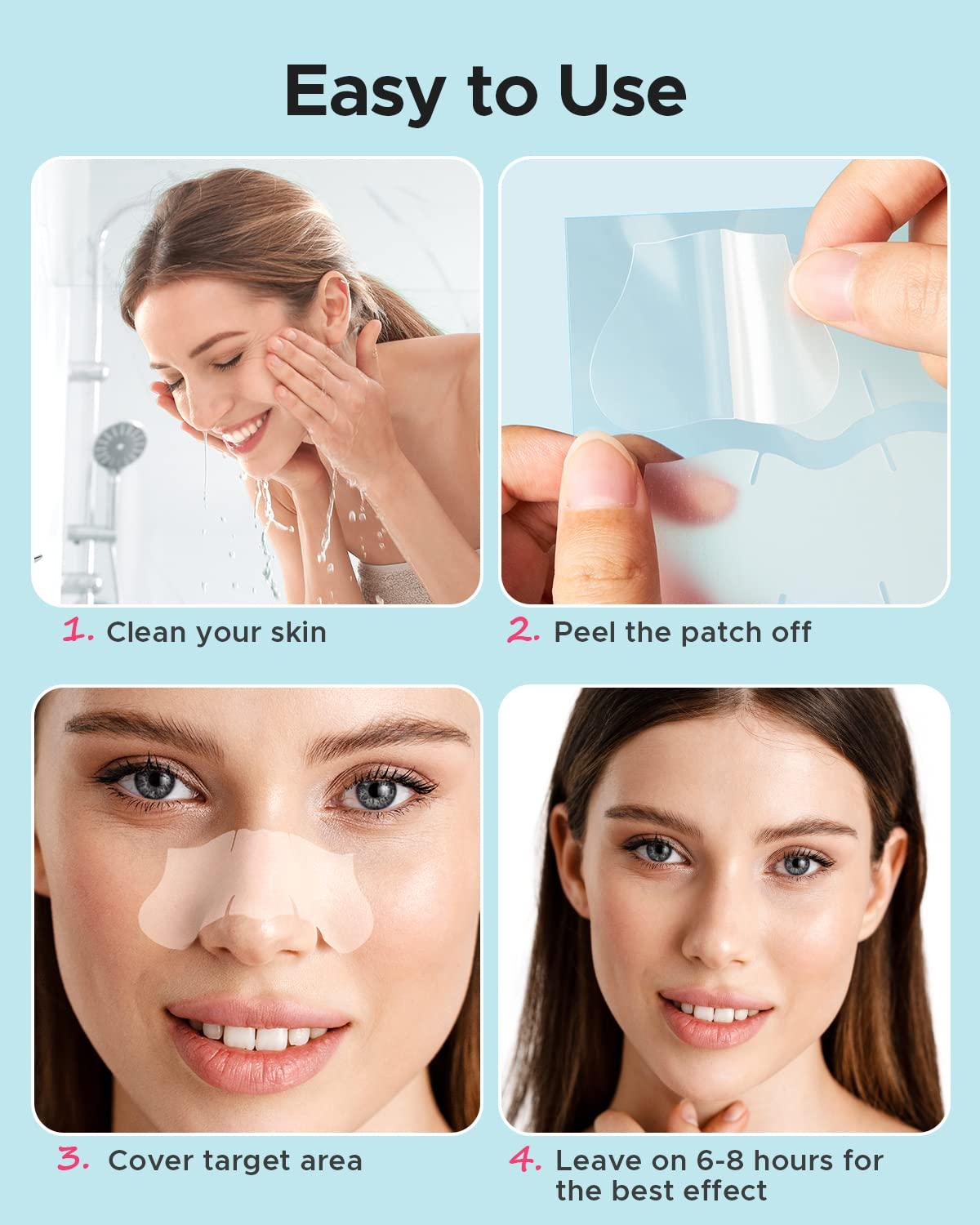 LitBear XL T-Zone Patch - 30 Patches, Hydrocolloid for Nose, Forehead ...