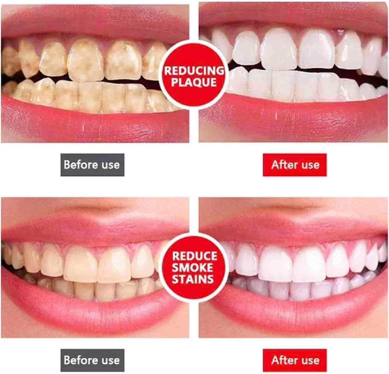 Gum Protection Toothpaste Without Fluoride Probiotic Protection ...