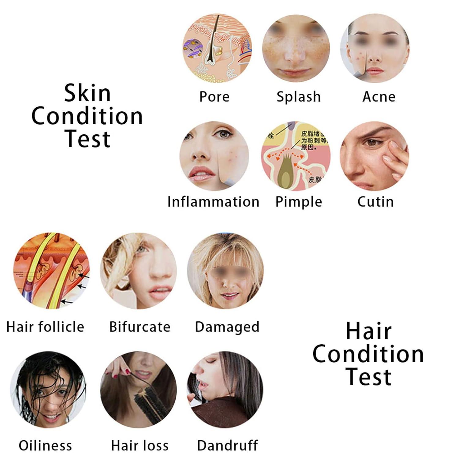 5-Inch Skin & Hair Analyzer | Hair Scalp Detector with Magnifying ...