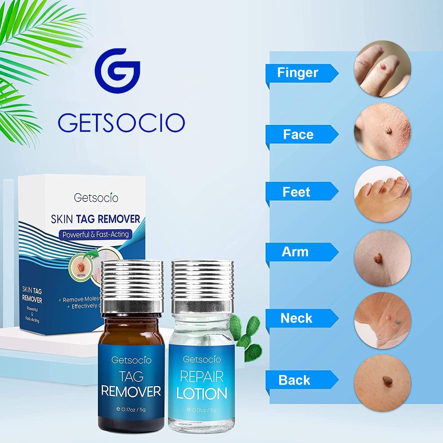 Getsocio Skin Tag & Mole Remover Set - Repair Skin, Remove Blemishes ...